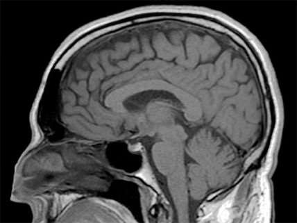 Addicted to Brain Scans