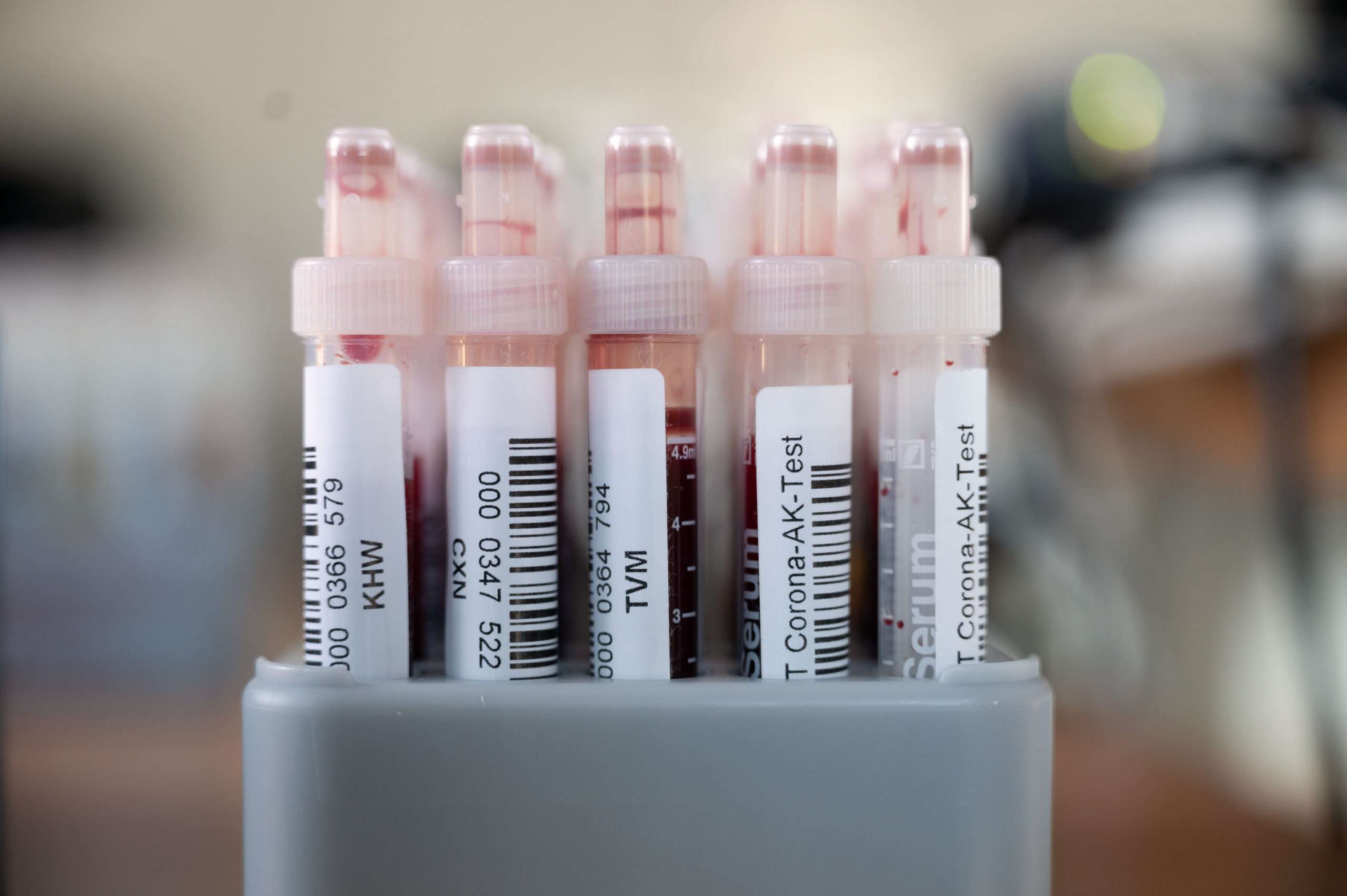 COVID-19 Pool Testing Is a Stopgap Measure To Track and Curb the Pandemic