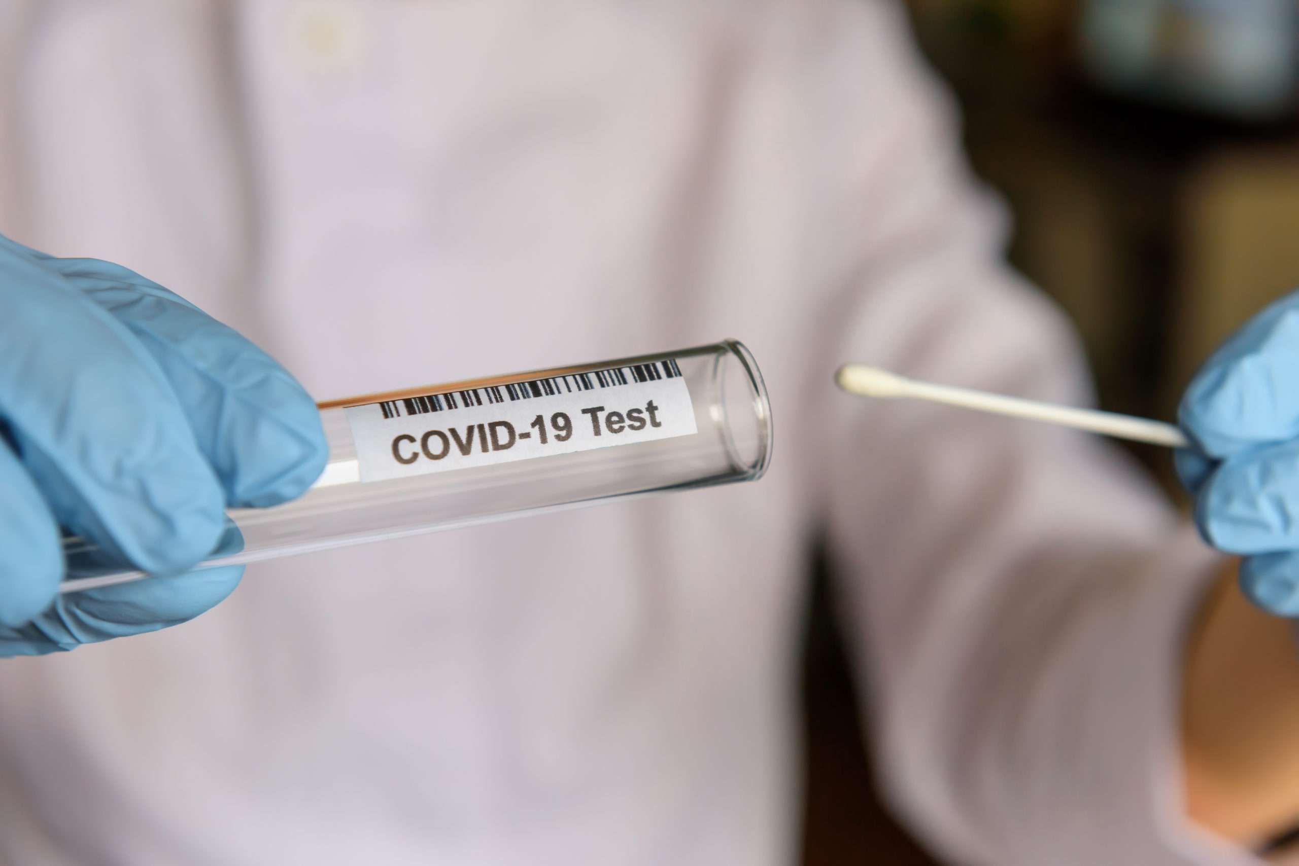 CDC Issues New Guidelines That Discourage COVID-19 Diagnostic Testing