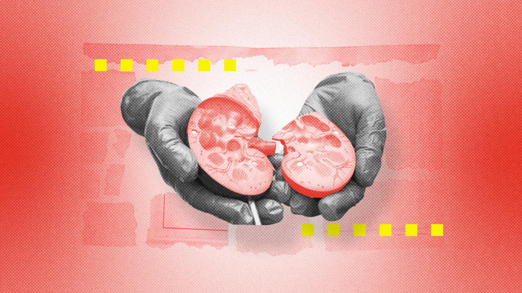 'Why We Can't Have Nice Things': The Case Of The 17,000 Missing Kidneys